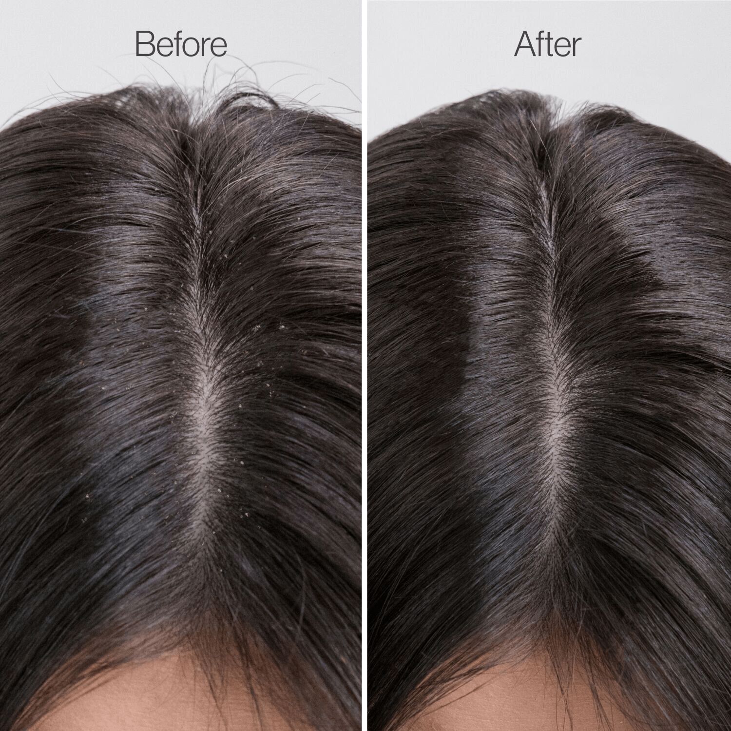 Freewill Gentle Exfoliating Scalp Scrub | Sally Beauty