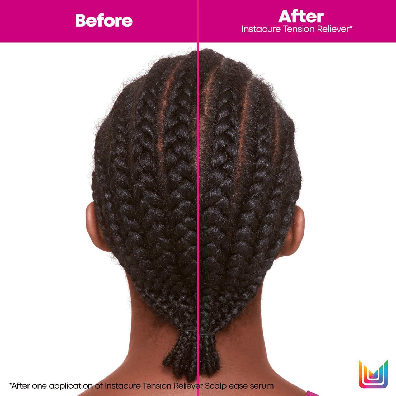 Matrix Instacure Tension Reliever | Scalp Care | Sally Beauty